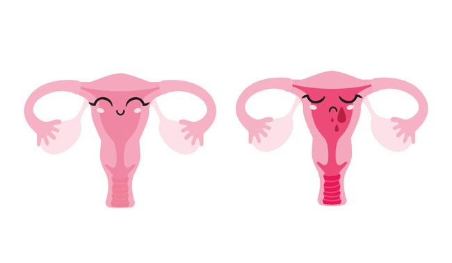 PMS Nedir, Kadınlar Regl Öncesi Neden Sinirli Olur? - En İyi Vitamin